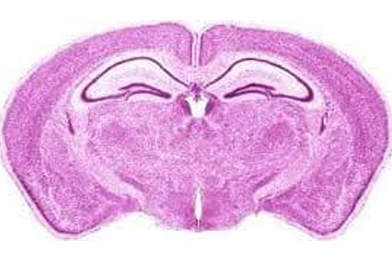 Tissue Sectioning for Histopathology | Precisionary Instruments