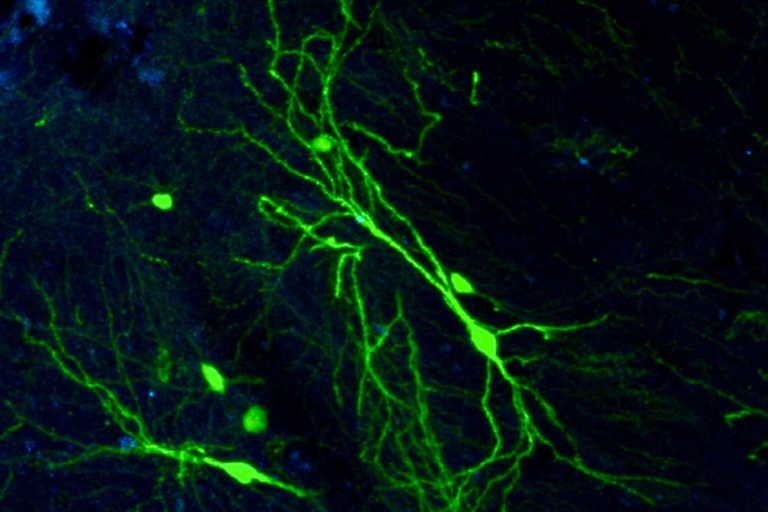Tissue Sectioning for Rat Brain Slices
